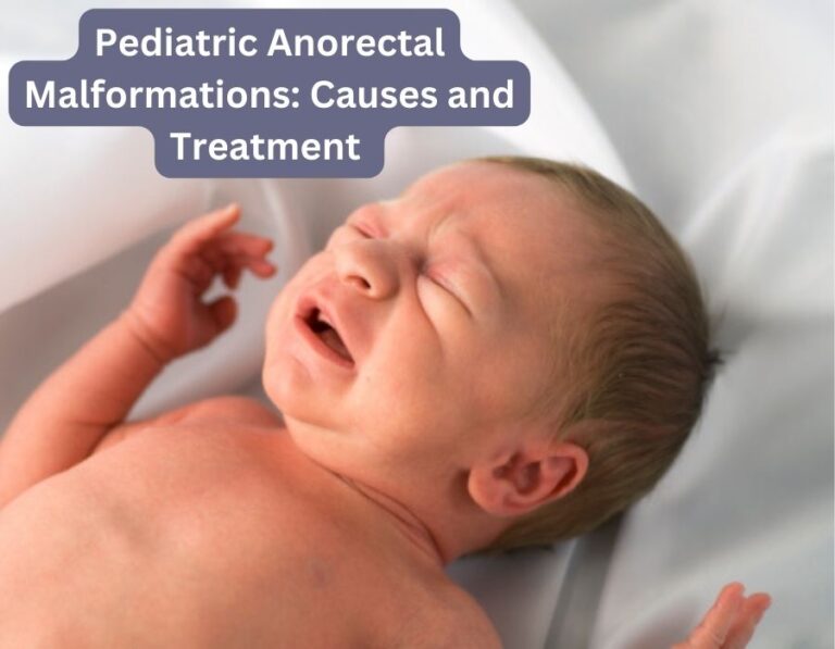 Pediatric Anorectal Malformations: Causes and Treatment
