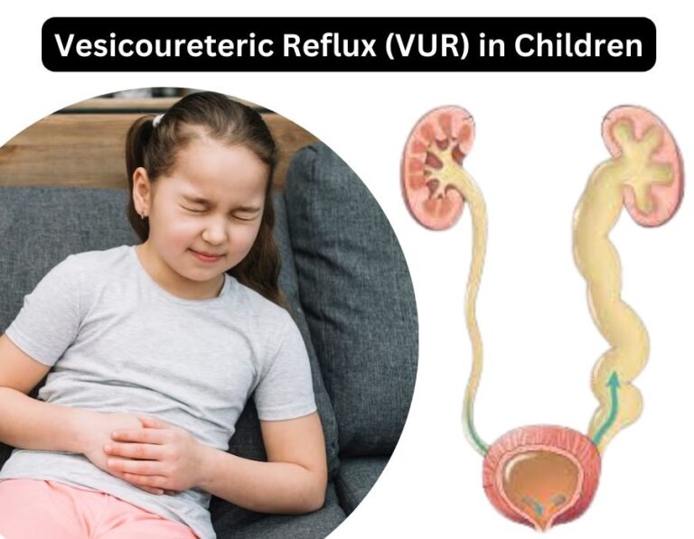 Vesicoureteric Reflux (VUR) in Children | Dr. Apoorva Kulkarni